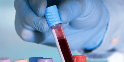 Dialysis Lab Results | Fresenius Kidney Care